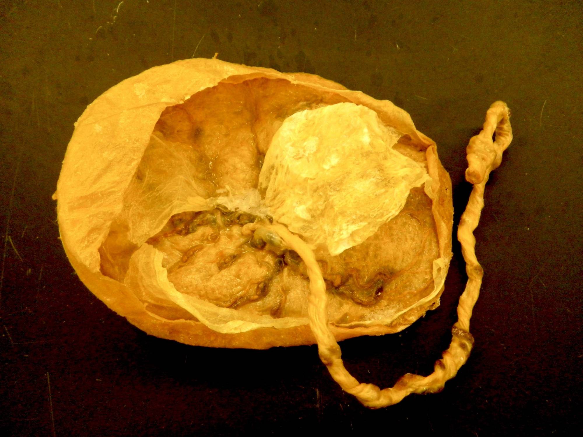 Plastination in BMS - Biomedical Sciences - Grand Valley State University